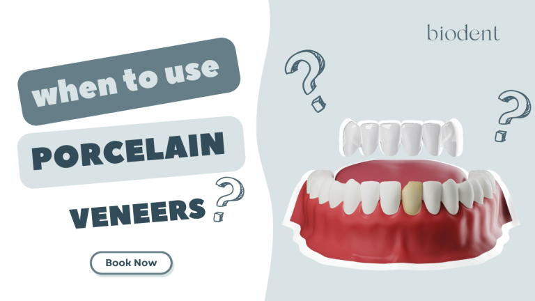 When To Use Porcelain Veneers In Miami, FL | Biohax Dental